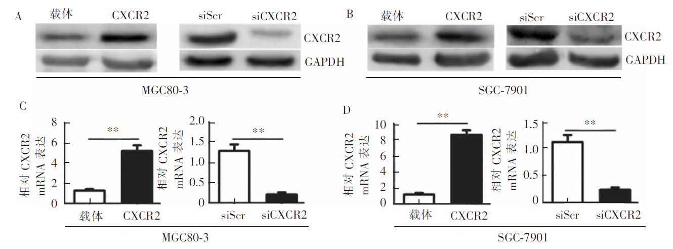 CXCR2对胃癌细胞侵袭、迁移及凋亡的影响